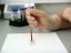 Chronic Fatigue Syndrome Breakthrough Boosts Cure Hopes